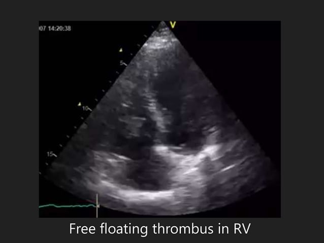 BASIC CARDIAC US.pptx