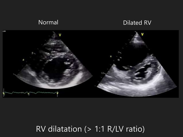 BASIC CARDIAC US.pptx