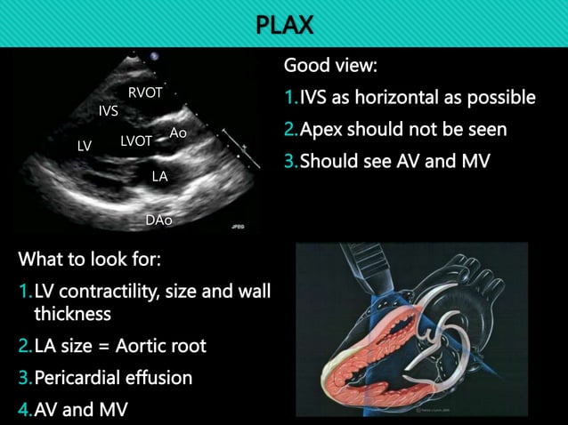 BASIC CARDIAC US.pptx