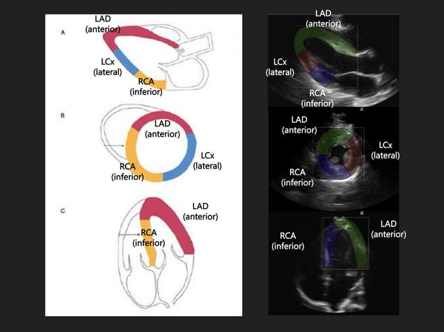 BASIC CARDIAC US.pptx