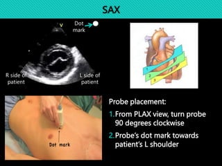 BASIC CARDIAC US.pptx