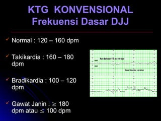Basic Cardiotocography Fak Kedokteran UPN.ppt