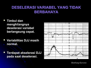 Basic Cardiotocography Fak Kedokteran UPN.ppt