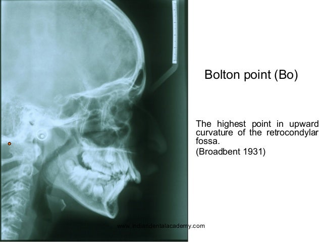 Basic cephalometrics