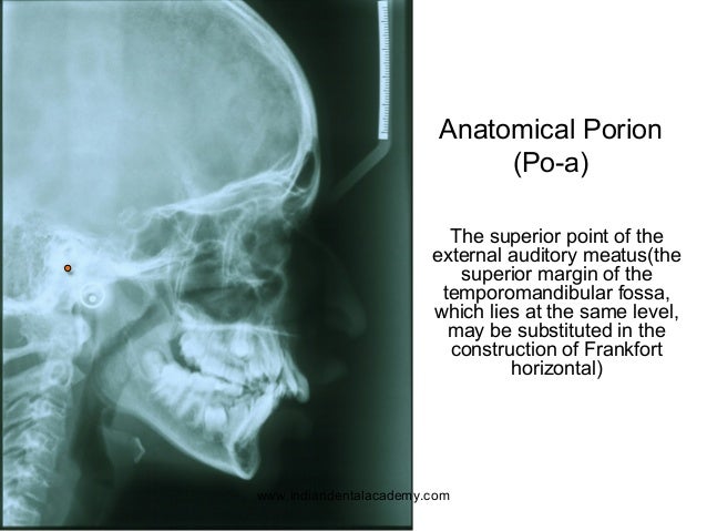 Basic cephalometrics