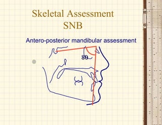 Basic cephalometrics | PPT