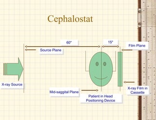 Basic cephalometrics | PPT