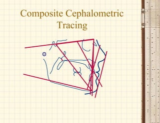 Basic cephalometrics | PPT