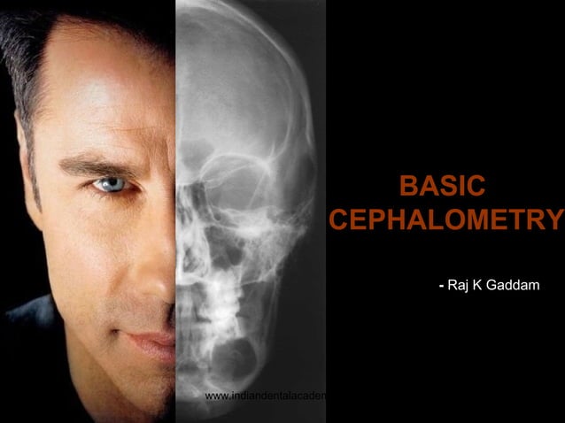 Basic cephalometry | PPT | Ear, Nose and Throat Conditions | Diseases and Conditions
