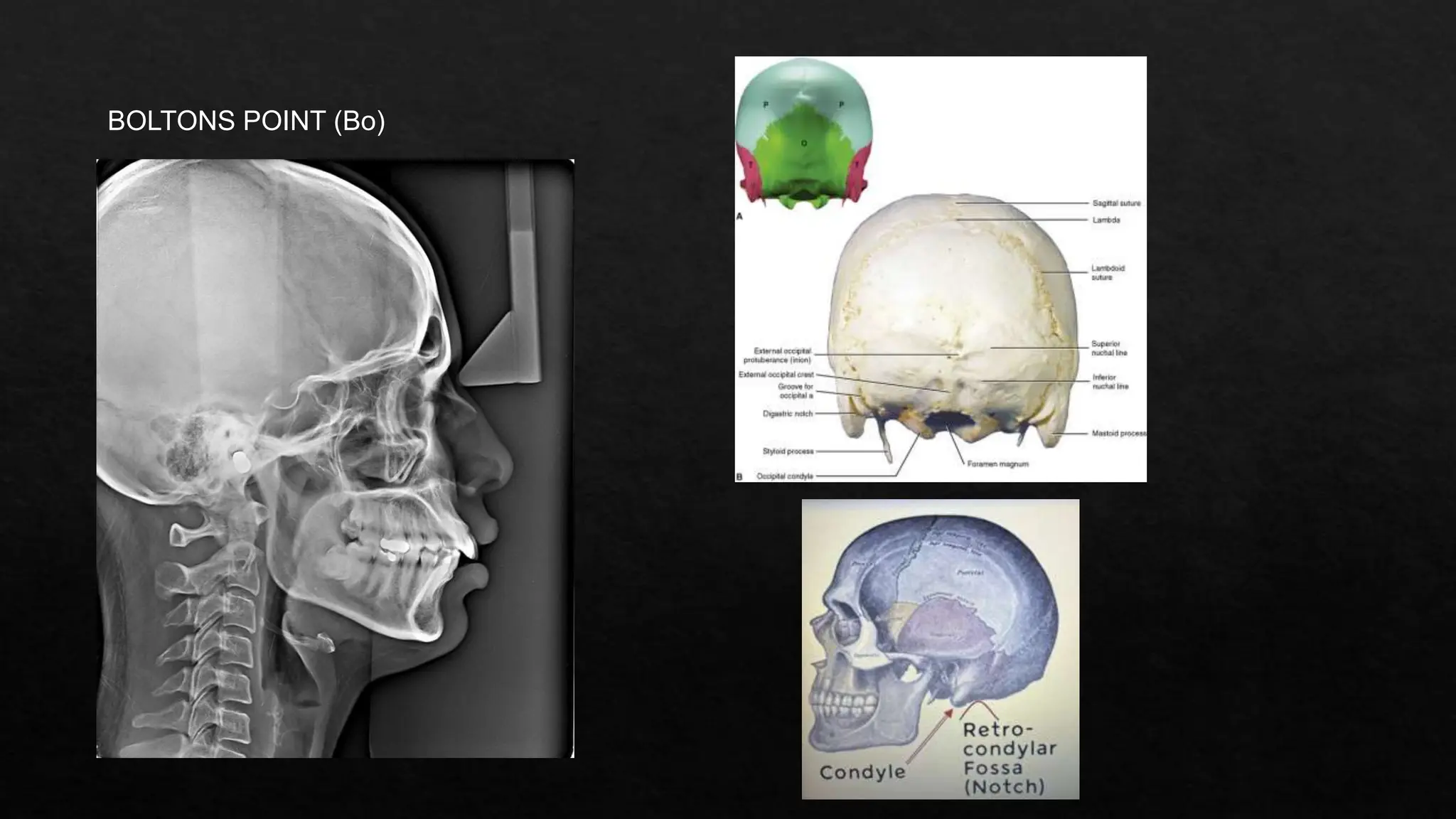 BASIC CEPHALOMETRY.pptx