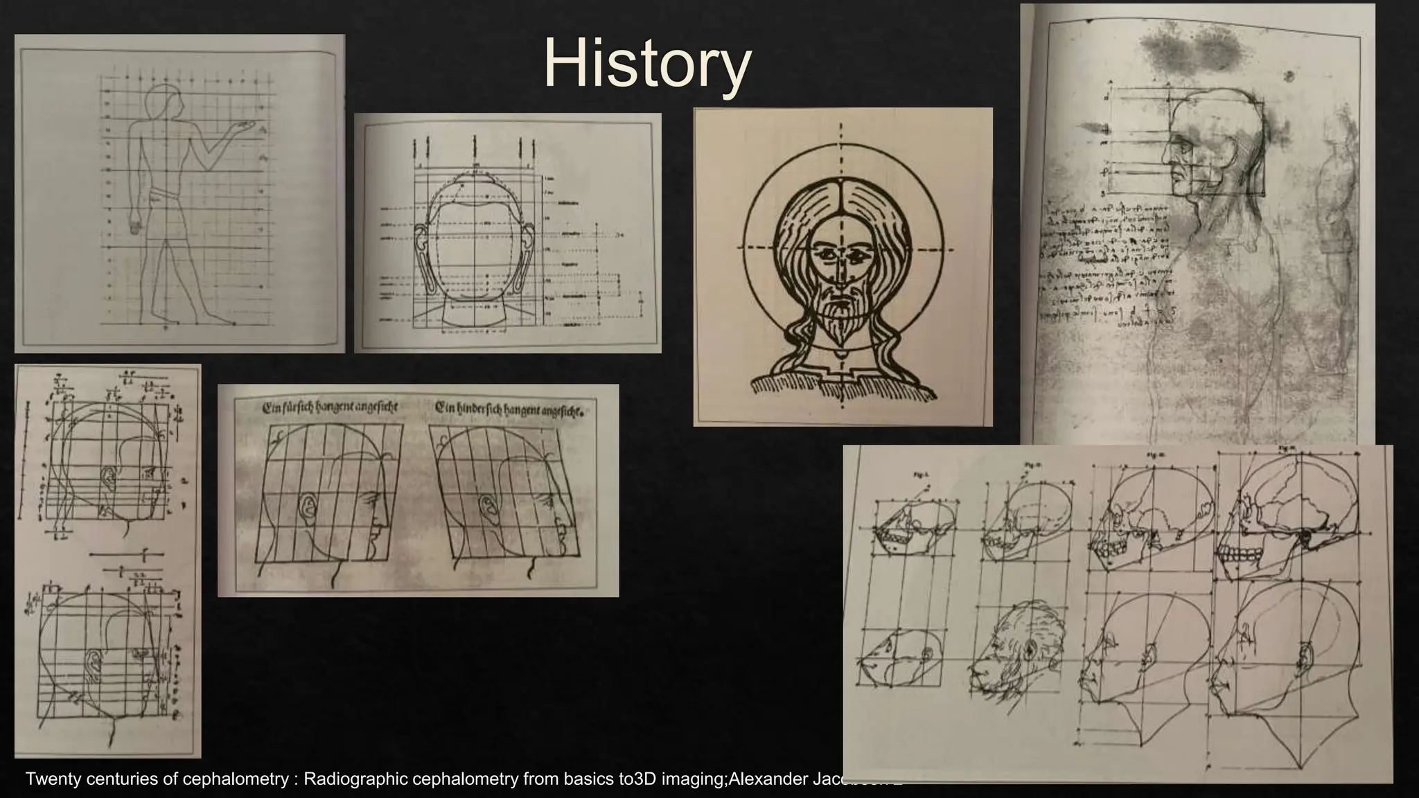 BASIC CEPHALOMETRY.pptx