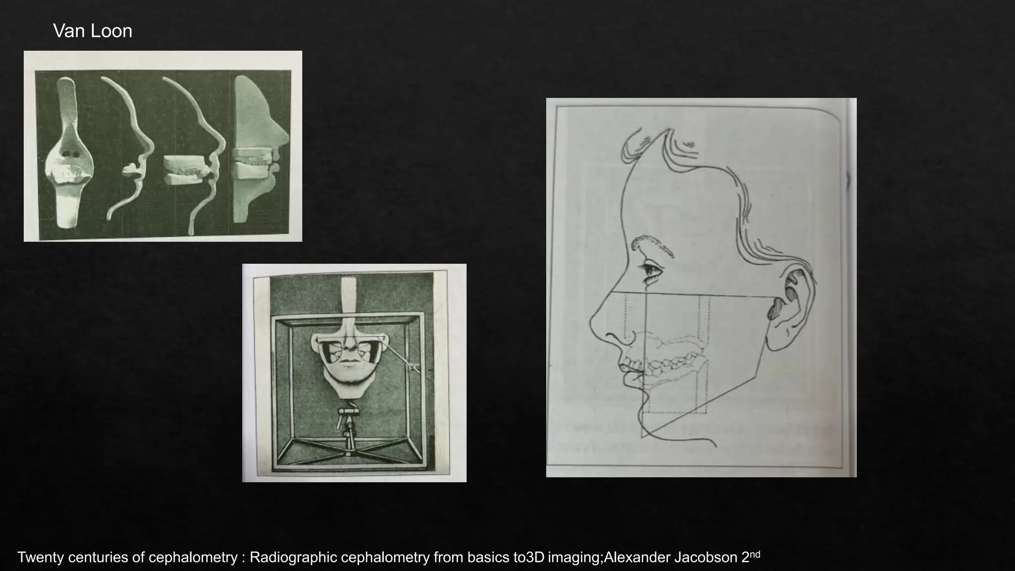 BASIC CEPHALOMETRY.pptx