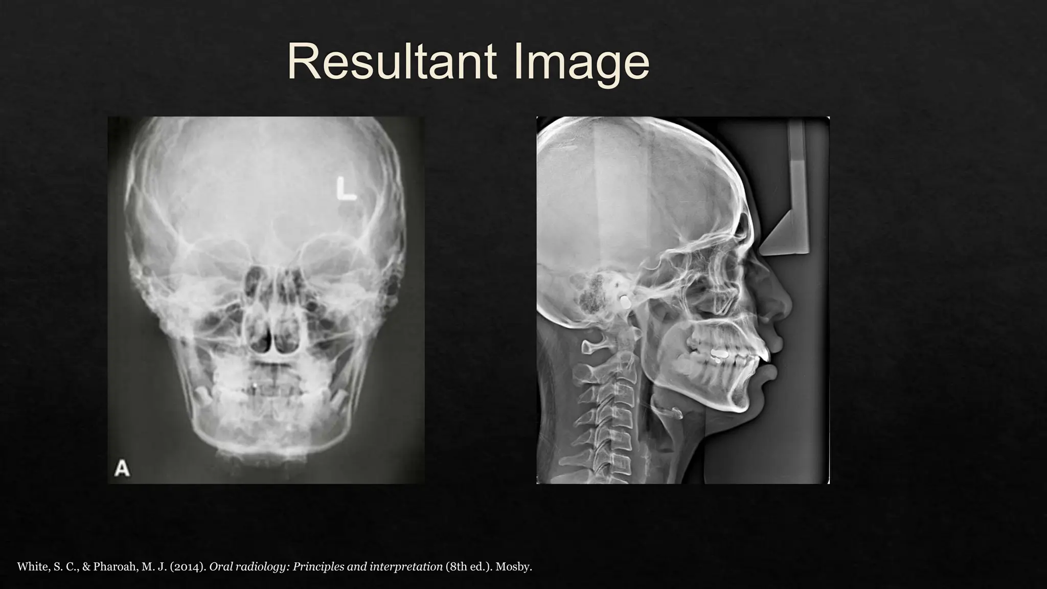 BASIC CEPHALOMETRY.pptx