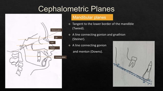 BASIC CEPHALOMETRY.pptx