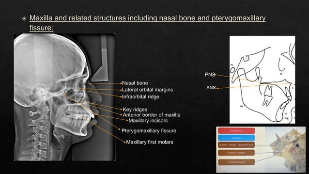 BASIC CEPHALOMETRY.pptx