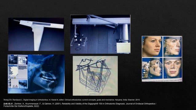 BASIC CEPHALOMETRY.pptx