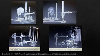 BASIC CEPHALOMETRY.pptx