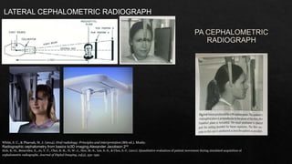BASIC CEPHALOMETRY.pptx