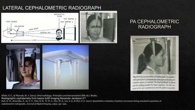 BASIC CEPHALOMETRY.pptx