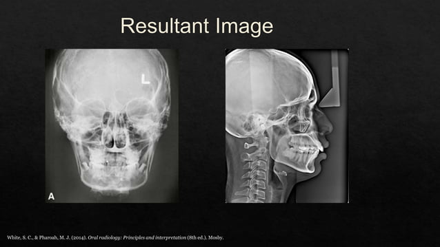 BASIC CEPHALOMETRY.pptx