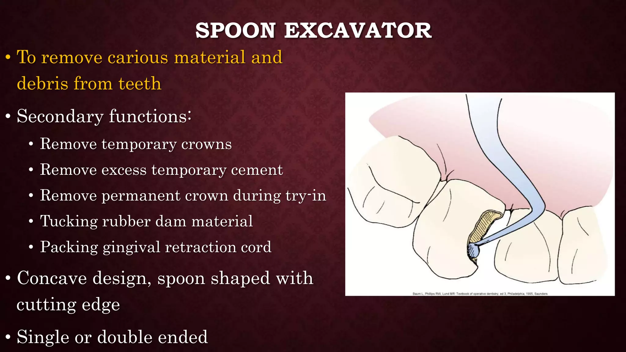 Basic Chairside Instruments: Tray Systems | PPTX
