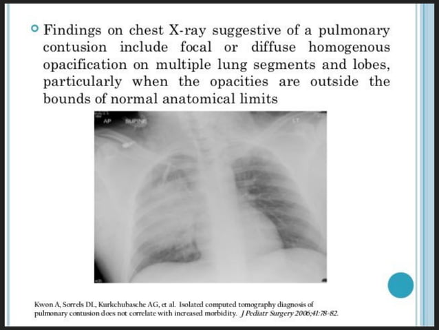 Basic chest trauma | PPT