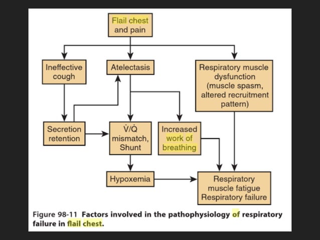 Basic chest trauma | PPT