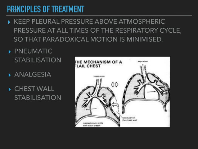 Basic chest trauma | PPT