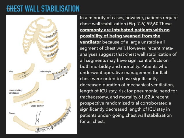 Basic chest trauma | PPT