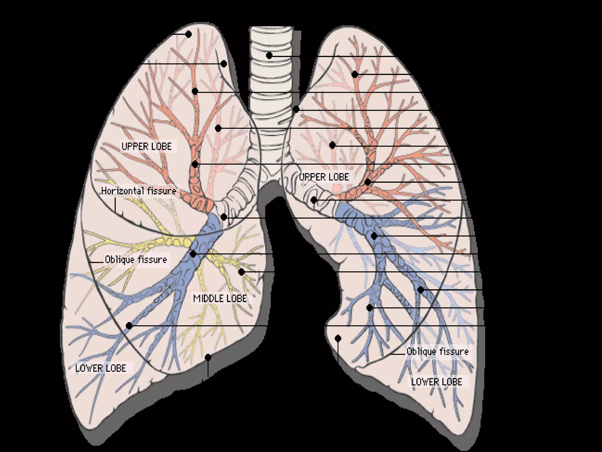 Basic chest x ray interpretation | PPT