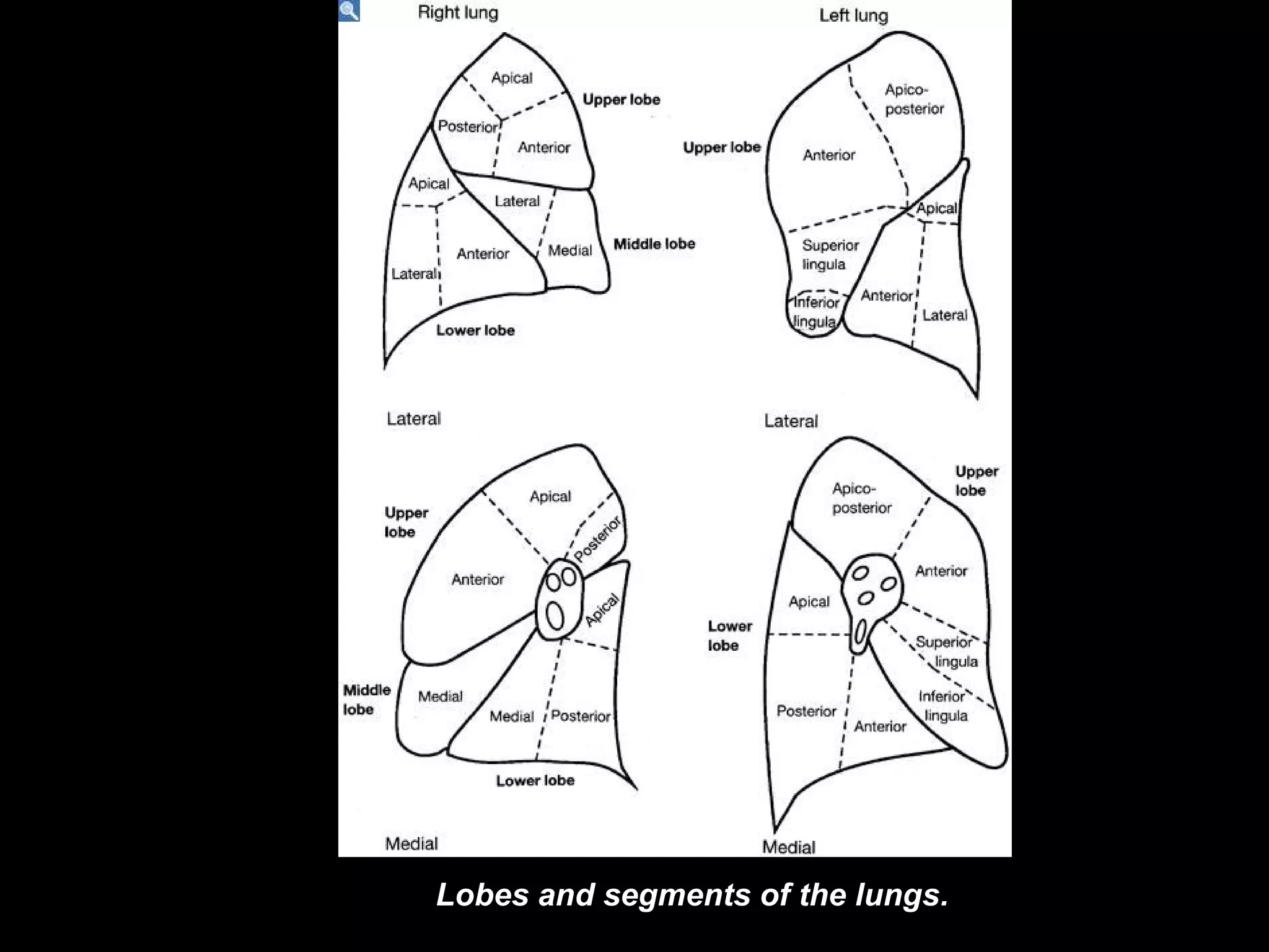 Basic chest x ray interpretation | PPT