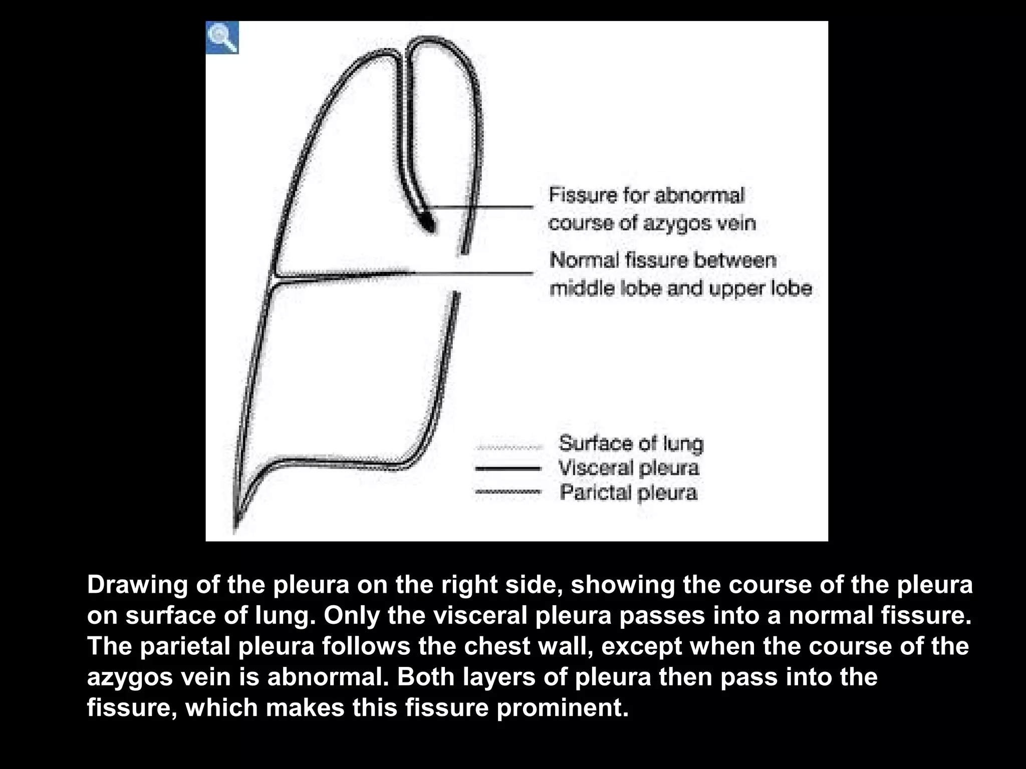 Basic chest x ray interpretation | PPT