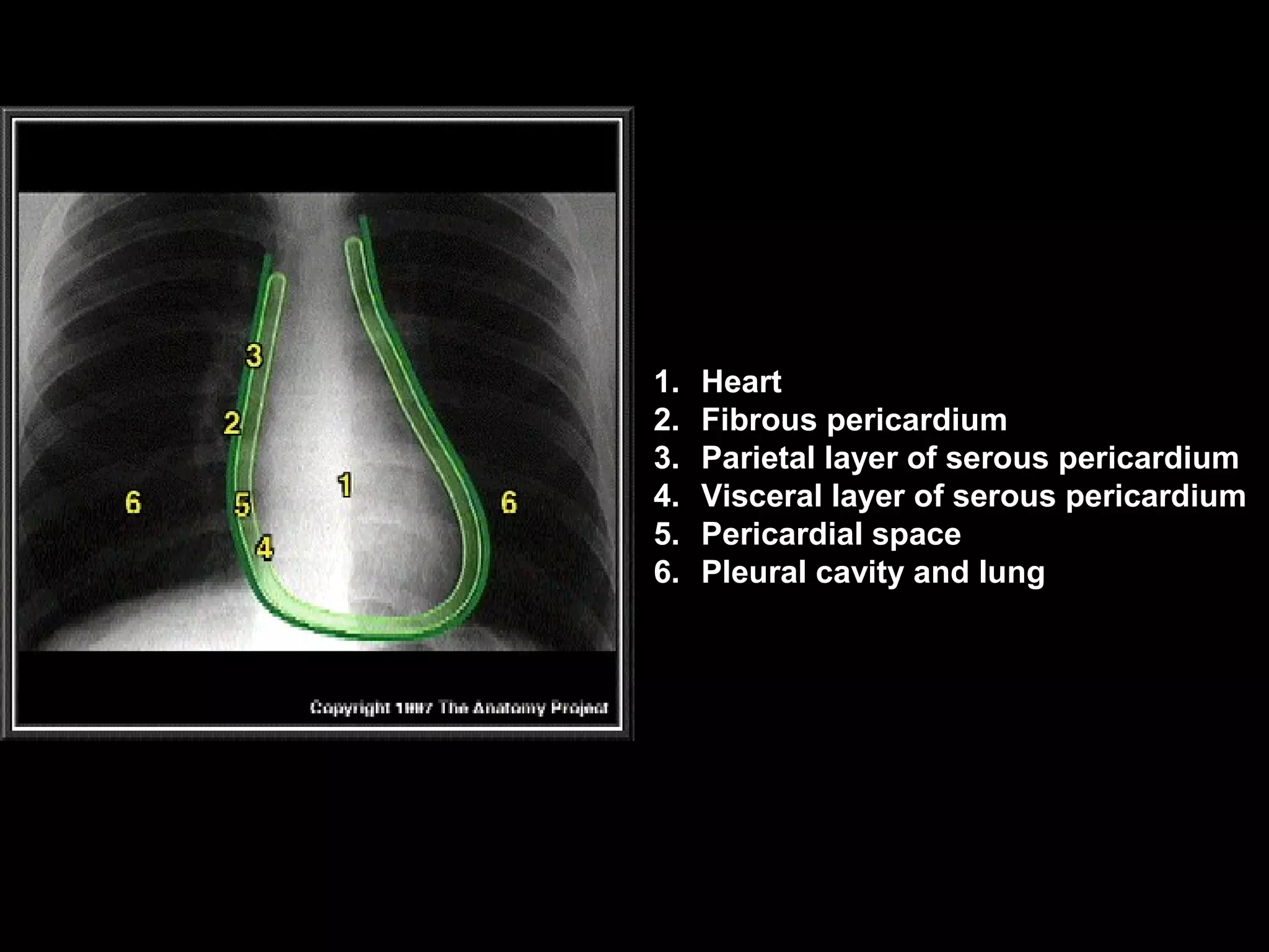 Basic chest x ray interpretation | PPT