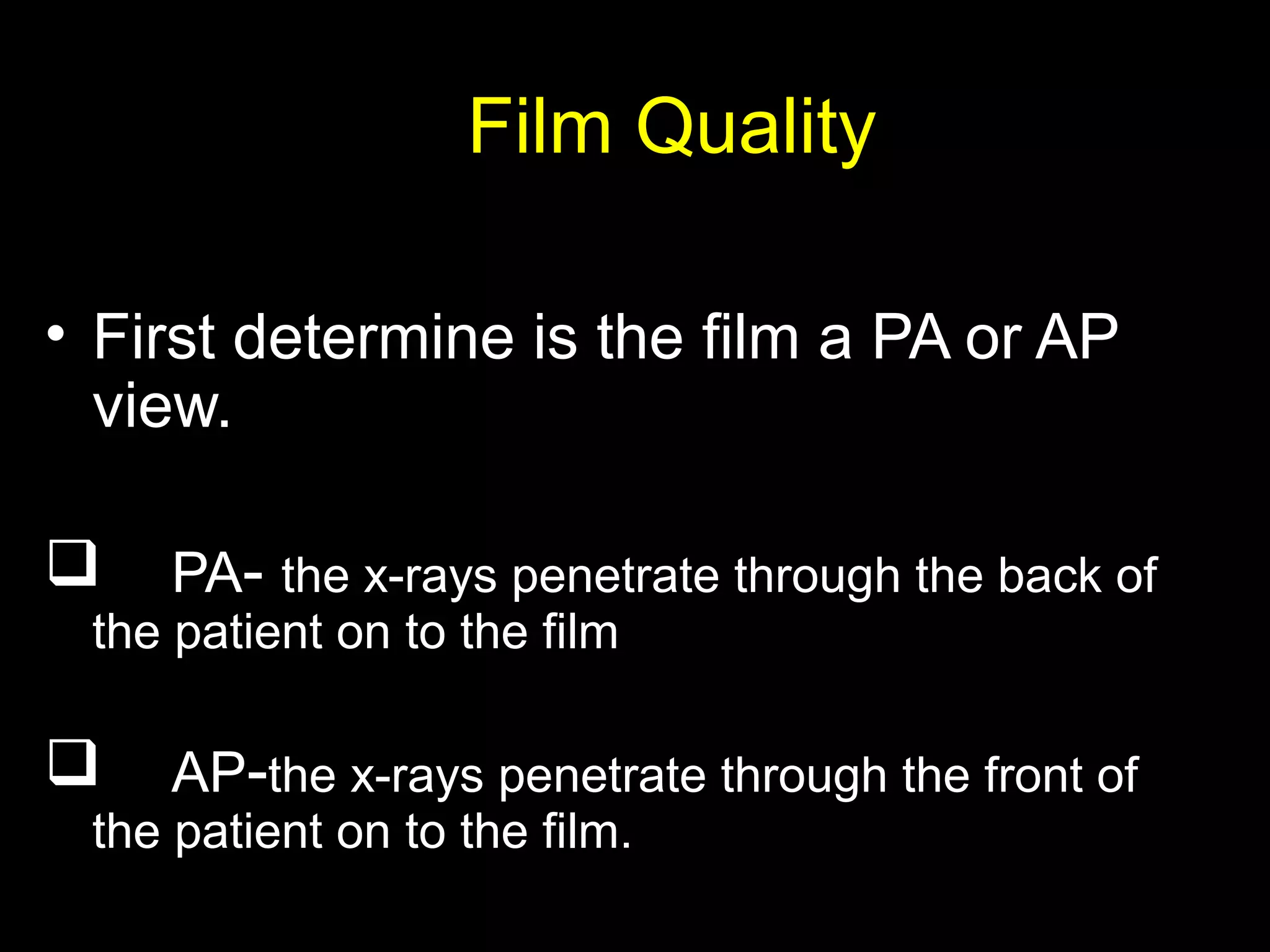 Basic chest x ray interpretation | PPT