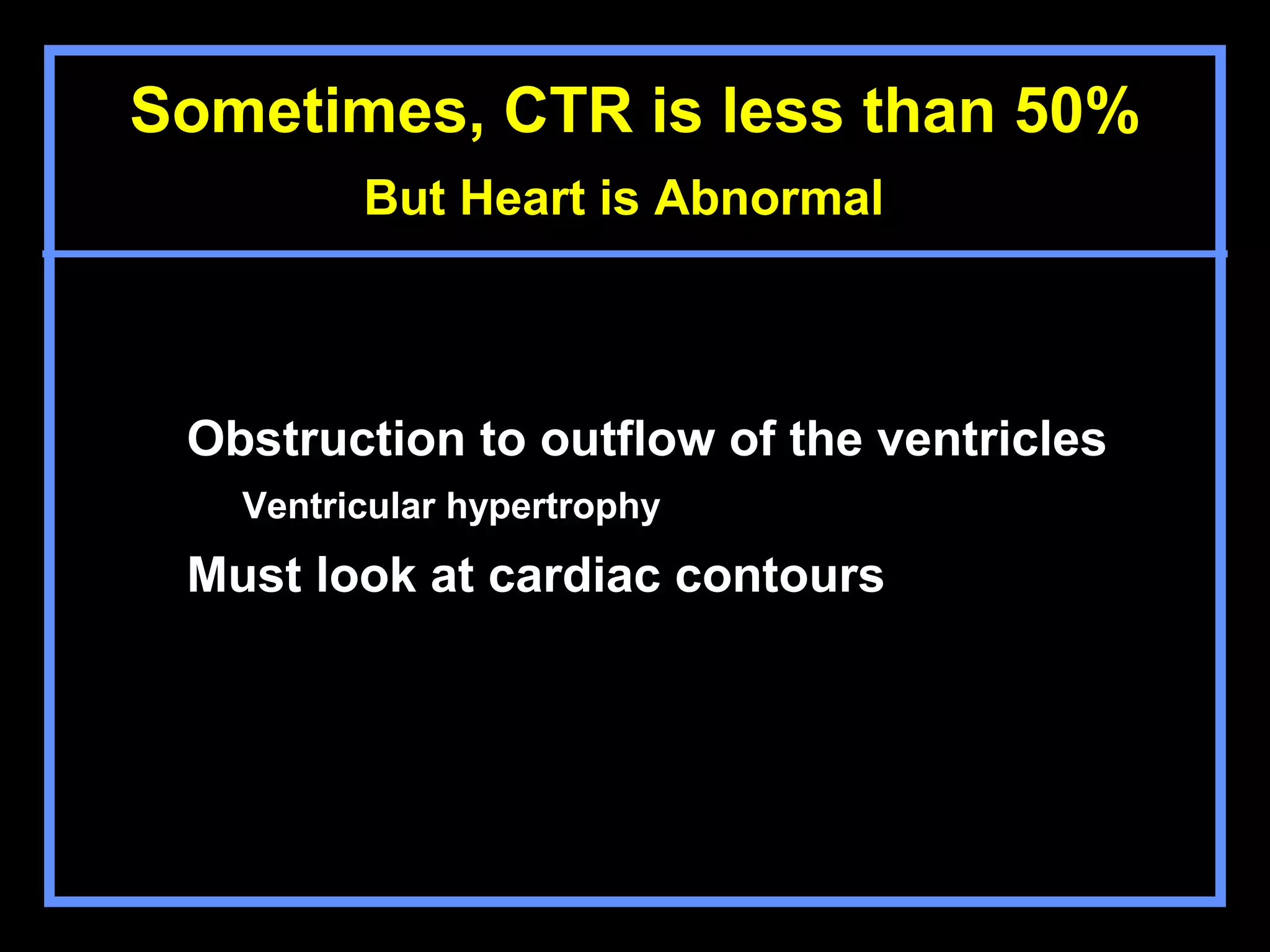 Basic chest x ray interpretation | PPT
