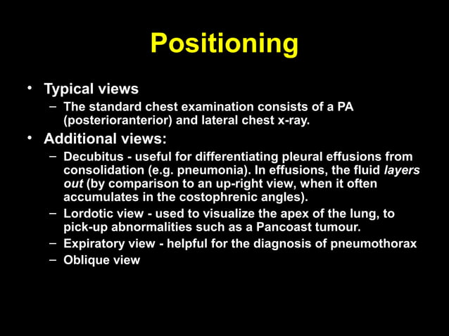 Basic chest x ray interpretation | PPT