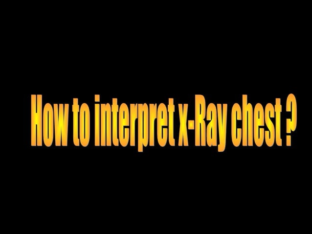 Basic chest x ray interpretation | PPT