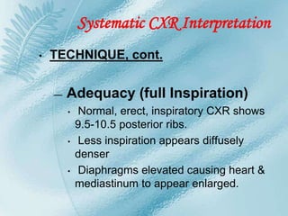 bbbbbbasic chest x-ray interpretation.ppt