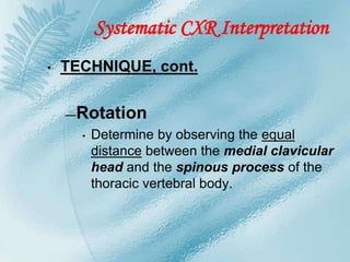 bbbbbbasic chest x-ray interpretation.ppt