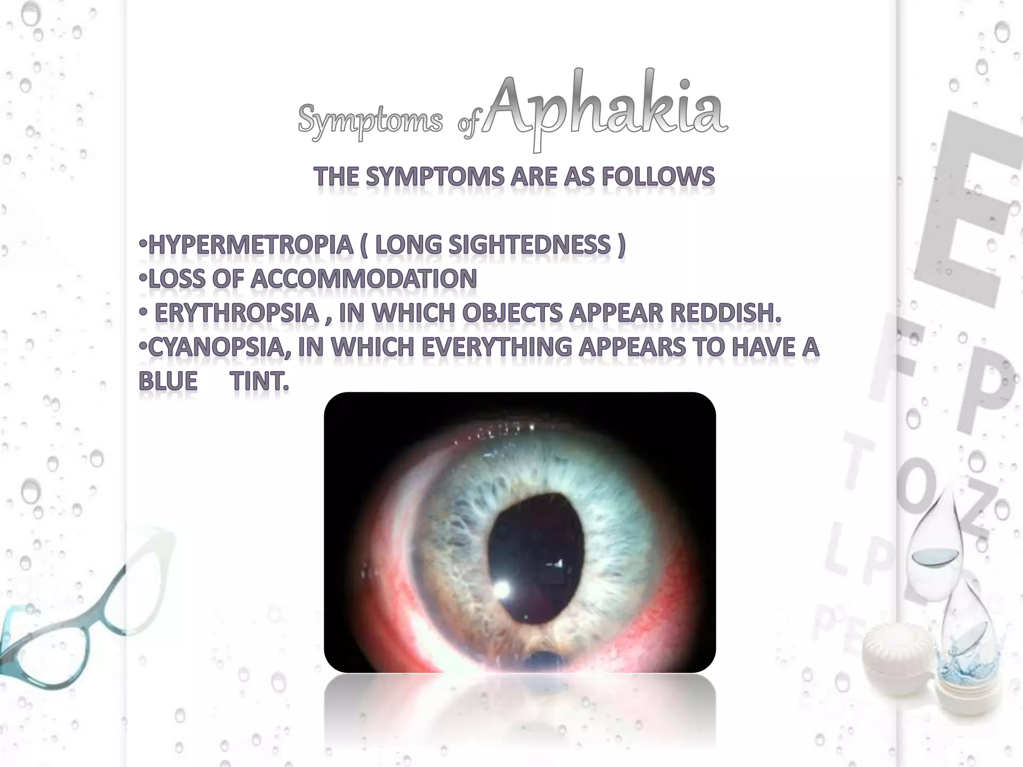 Aphakia,Causes ,Symptoms,signs,treatment | PPTX