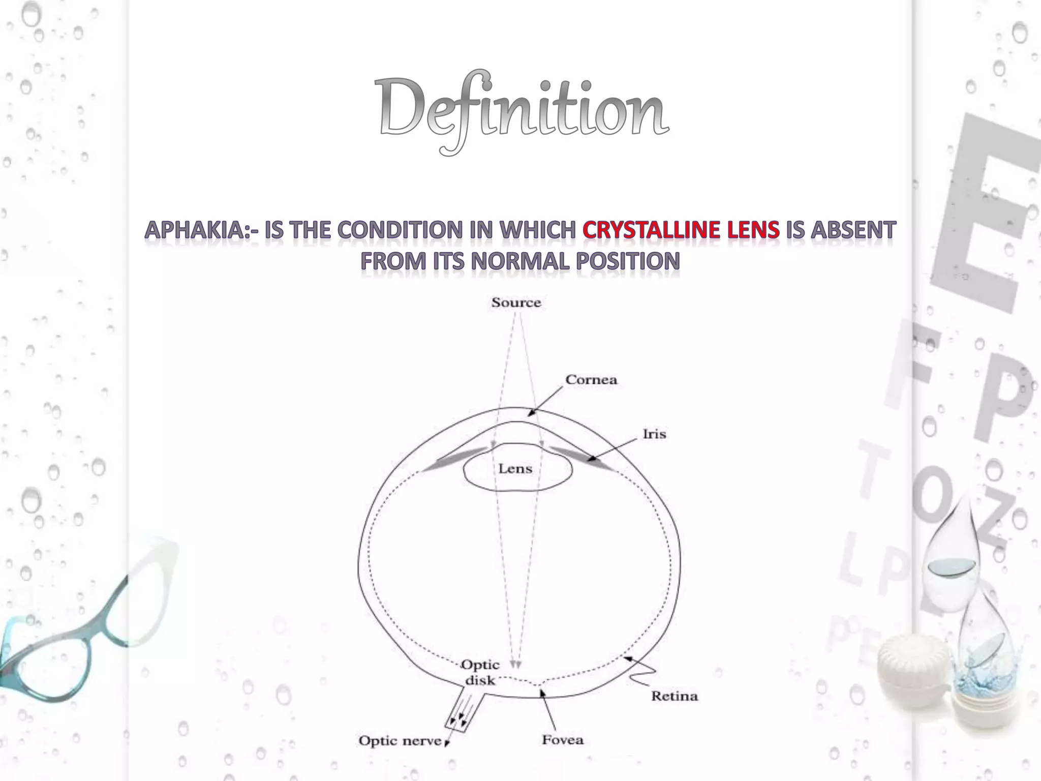 Aphakia,Causes ,Symptoms,signs,treatment | PPTX
