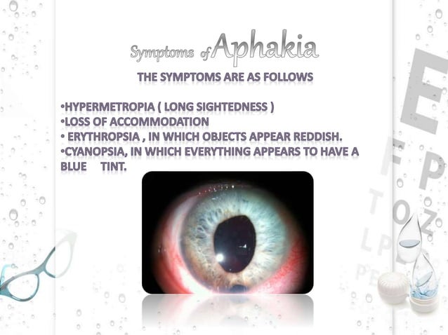 Aphakia,Causes ,Symptoms,signs,treatment | PPTX