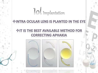 Aphakia,Causes ,Symptoms,signs,treatment | PPTX