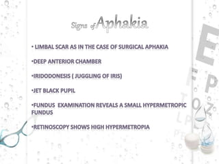 Aphakia | PPTX