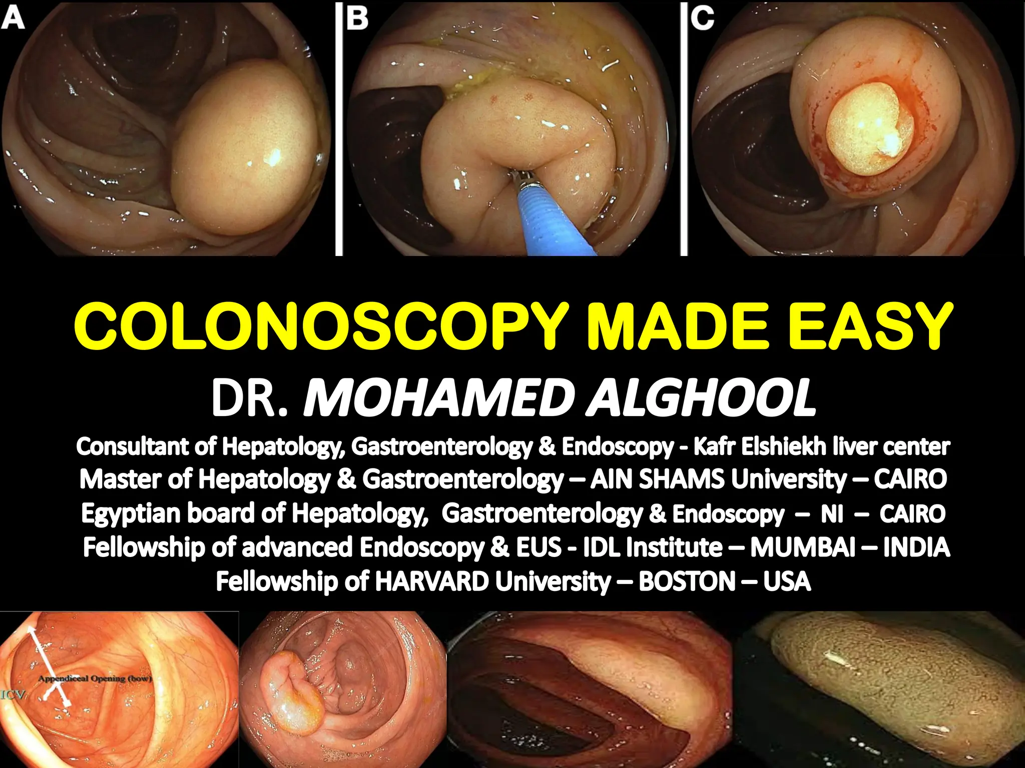 Colonoscopy made easy /Basic colonoscopy.pdf