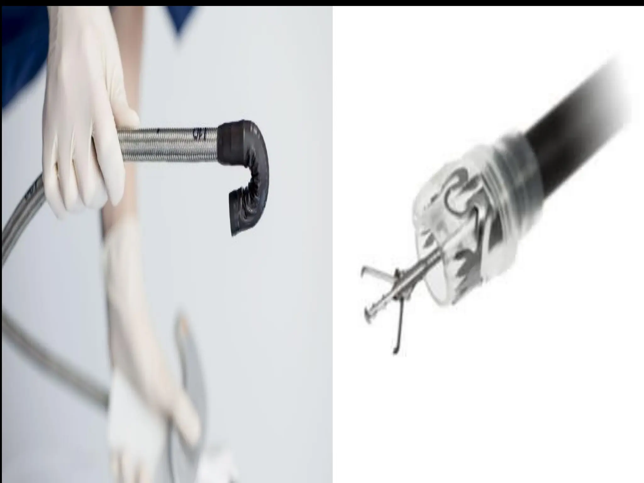 Colonoscopy made easy /Basic colonoscopy.pdf