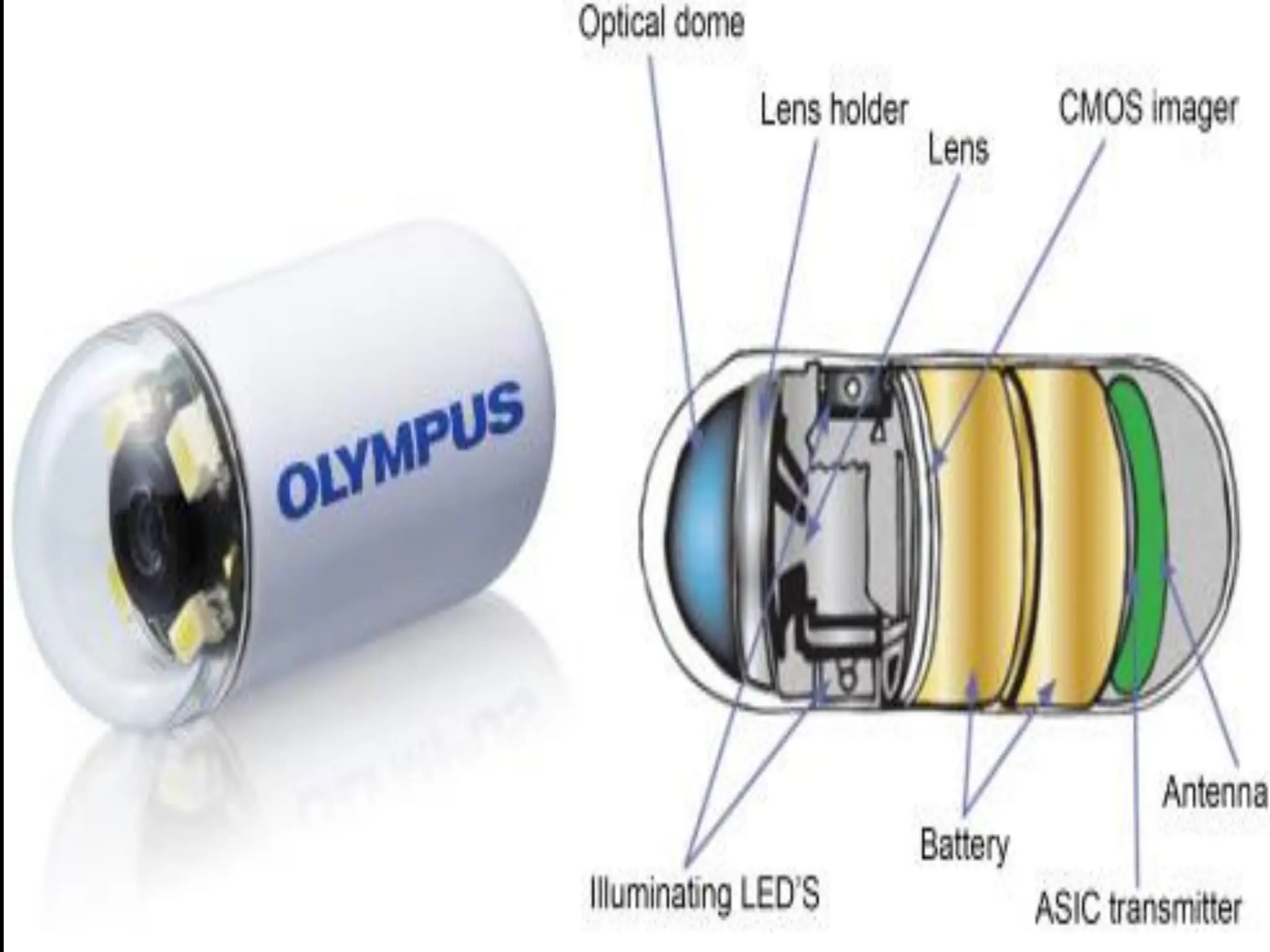 Colonoscopy made easy /Basic colonoscopy.pdf