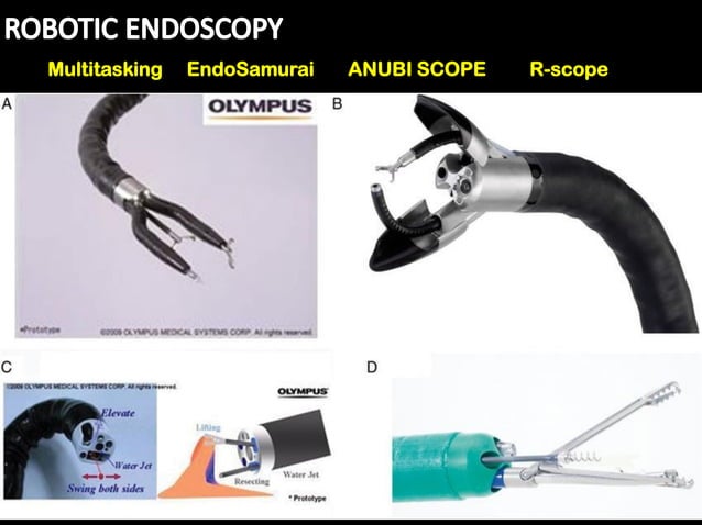 Colonoscopy made easy /Basic colonoscopy.pdf