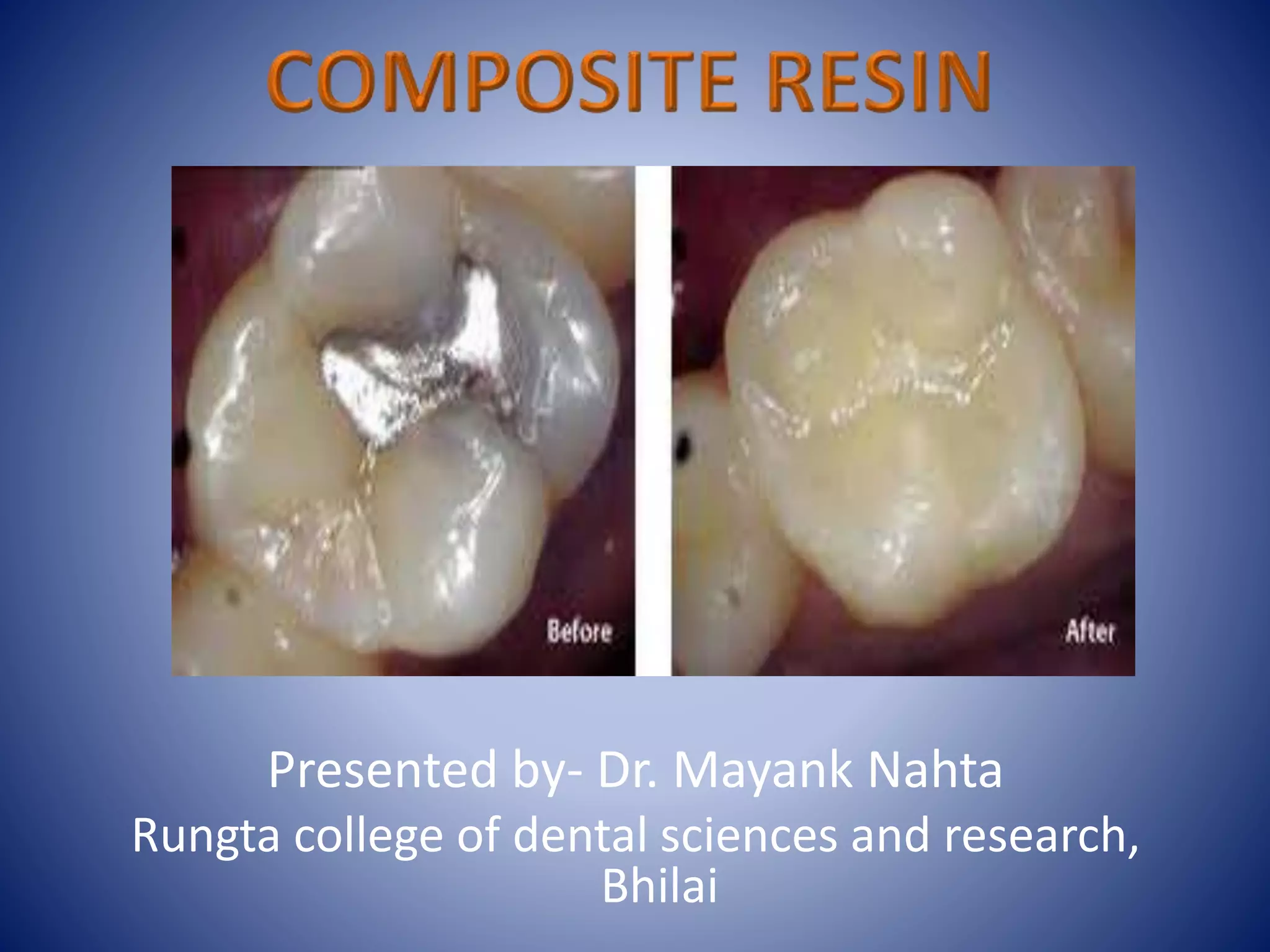 Composite resin restoration in dentistry | PPTX