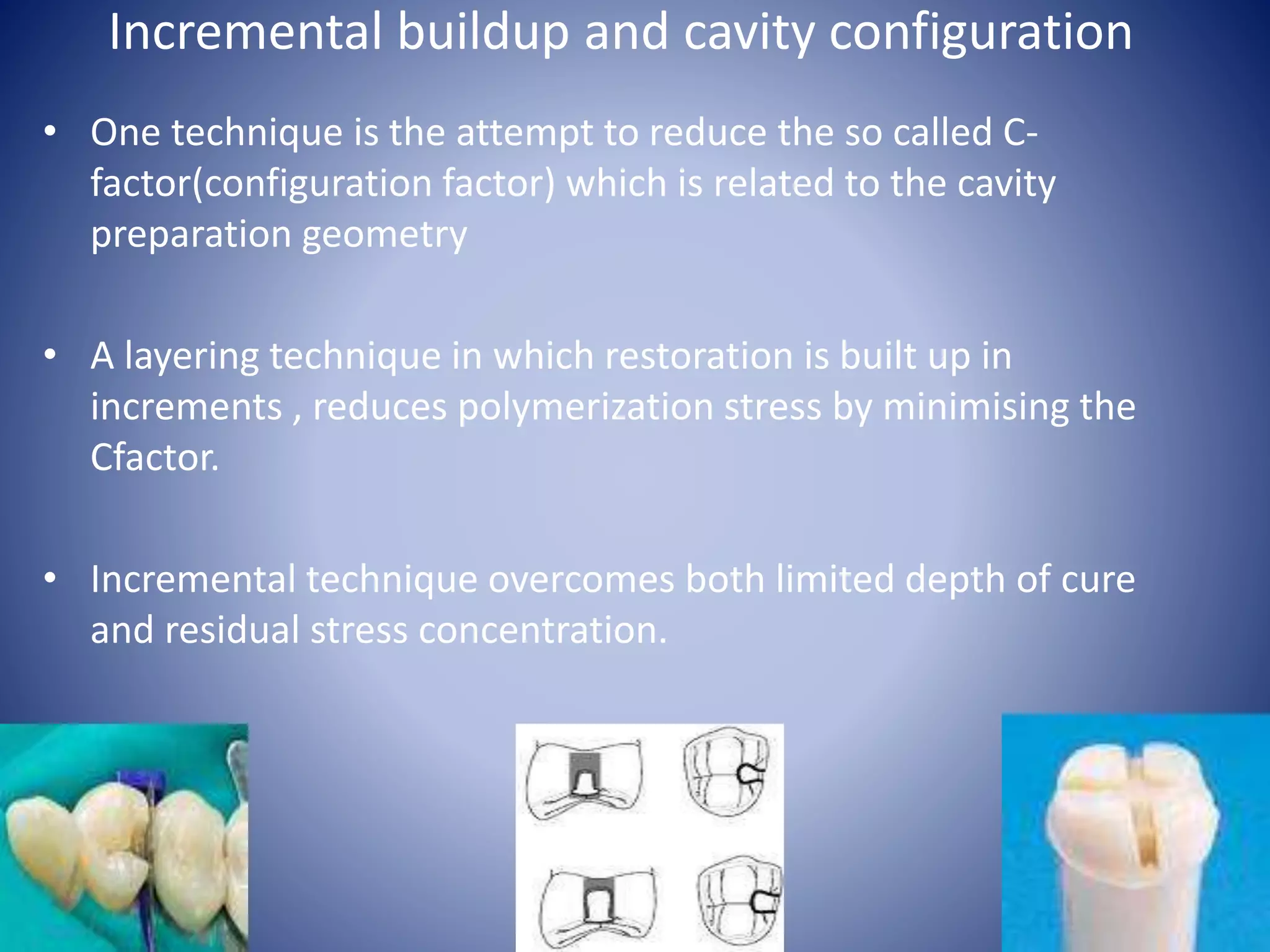Composite resin restoration in dentistry | PPTX